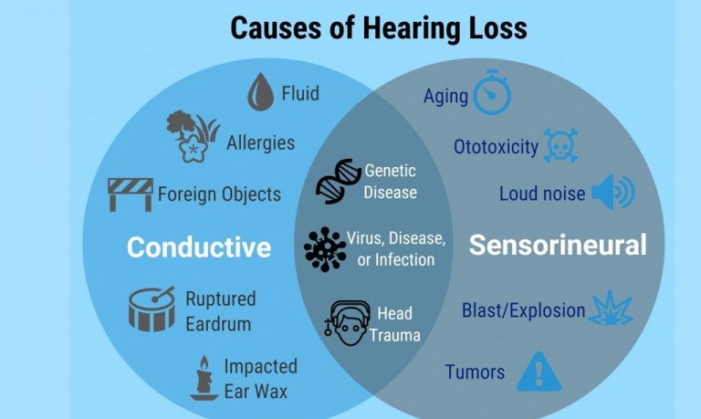 Causes Of Hearing Loss Deafness Common Hearing Loss